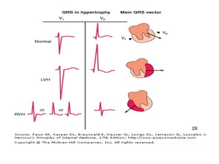 Basic ECG presentation, interval measurement, | PPT