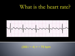 Basic ecg1 | PPTX