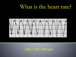 Basic ecg1 | PPTX