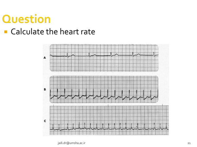Basic ecg1 | PPT | Free Download