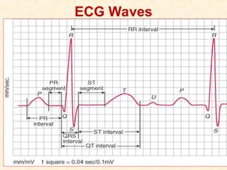 lecture on basic ecg for doctors and nurses | PPT