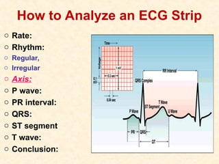 lecture on basic ecg for doctors and nurses | PPT
