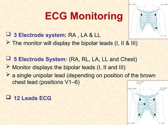 lecture on basic ecg for doctors and nurses | PPT