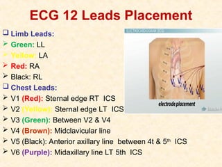 lecture on basic ecg for doctors and nurses | PPT