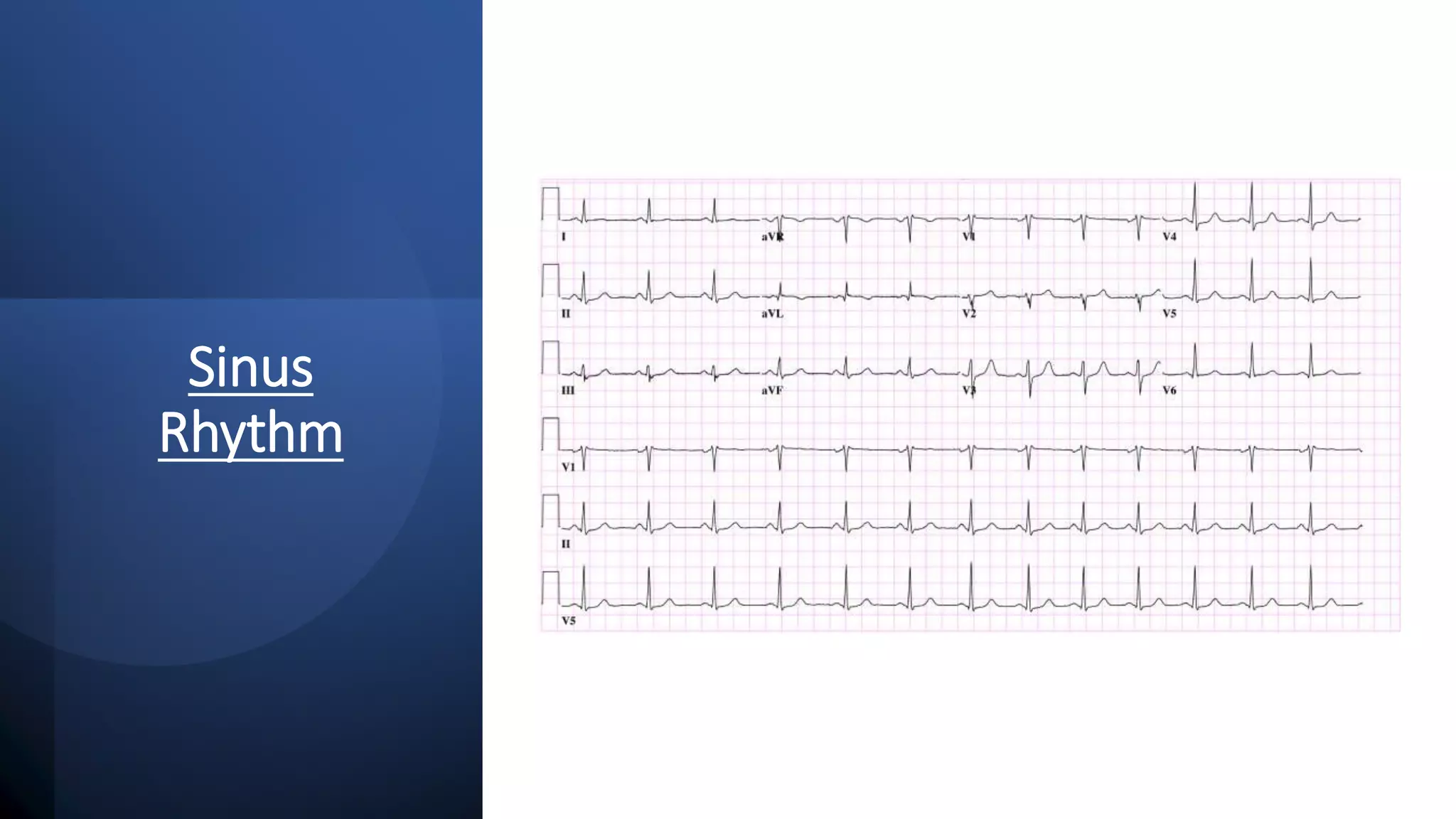 Basic ECG Interpretation.pptx