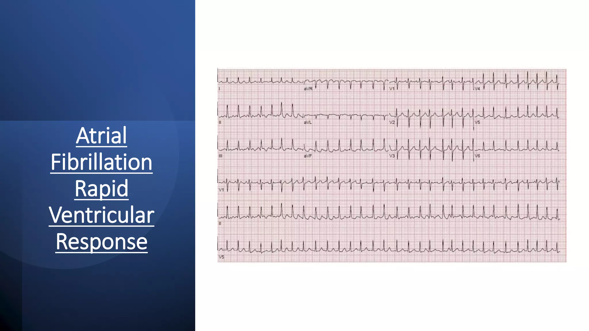 Basic ECG Interpretation.pptx