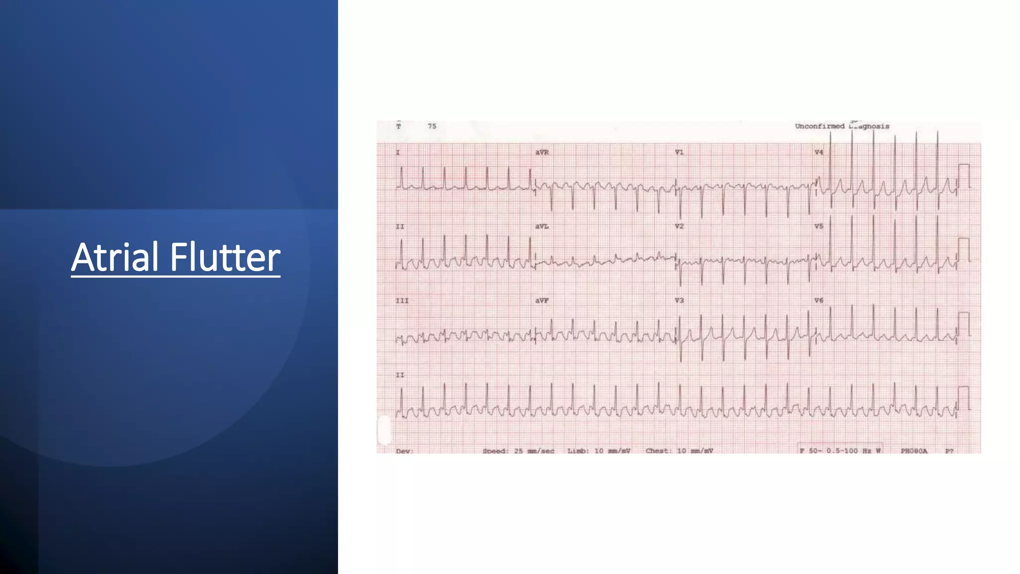 Basic ECG Interpretation.pptx