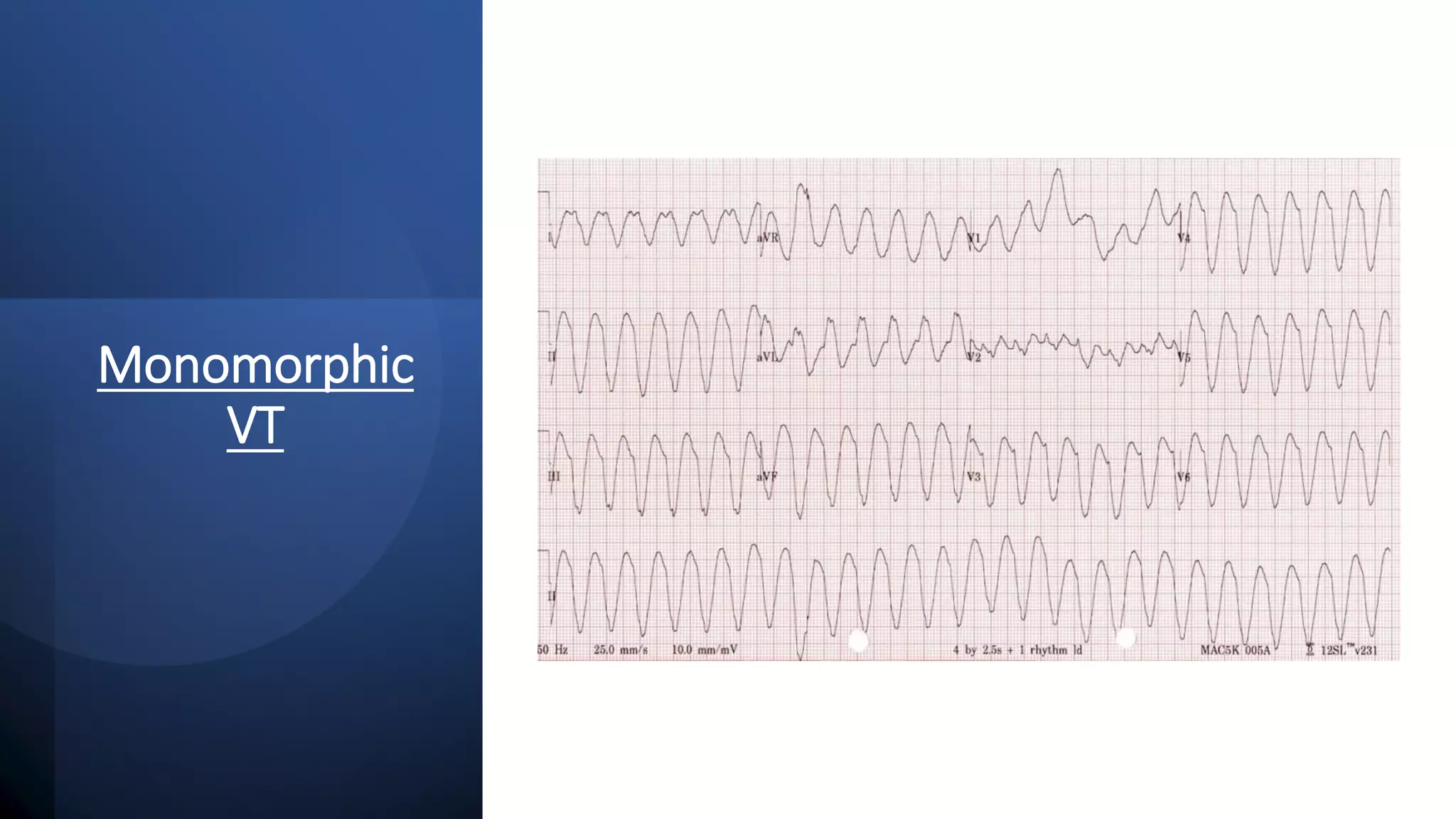 Basic ECG Interpretation.pptx