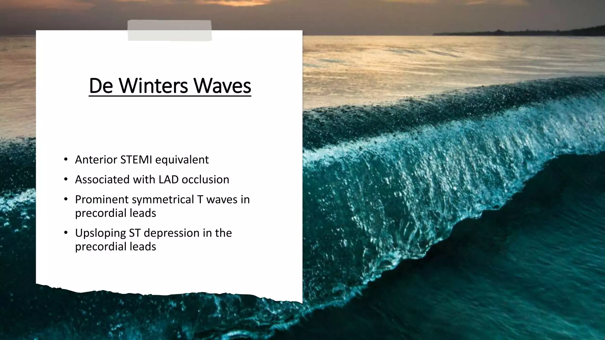 Basic ECG Interpretation.pptx