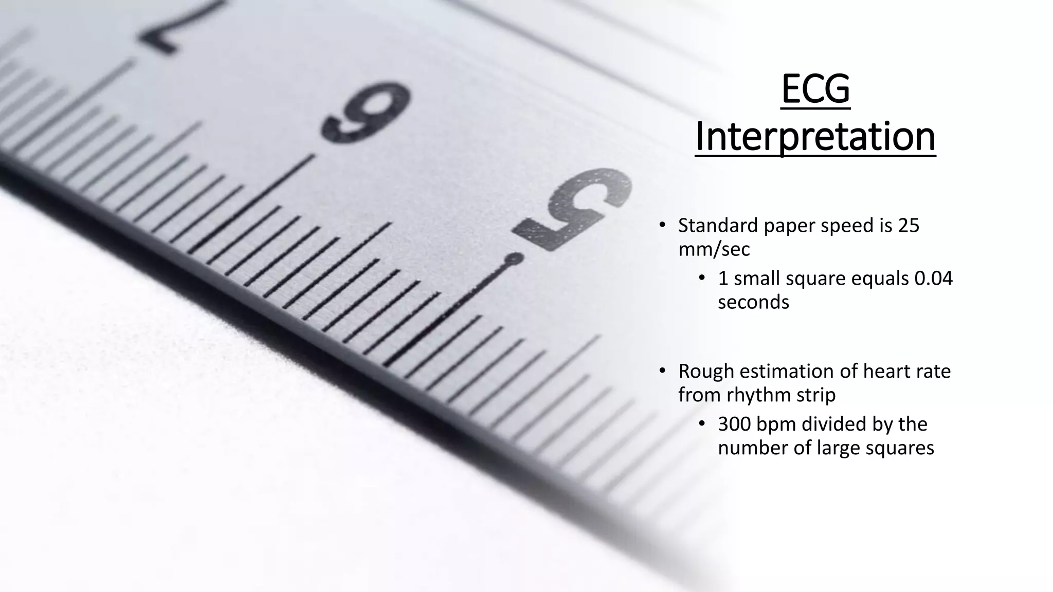 Basic ECG Interpretation.pptx