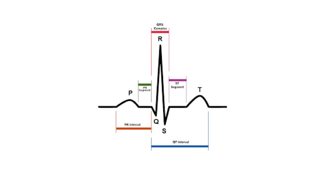 Basic ECG Interpretation.pptx