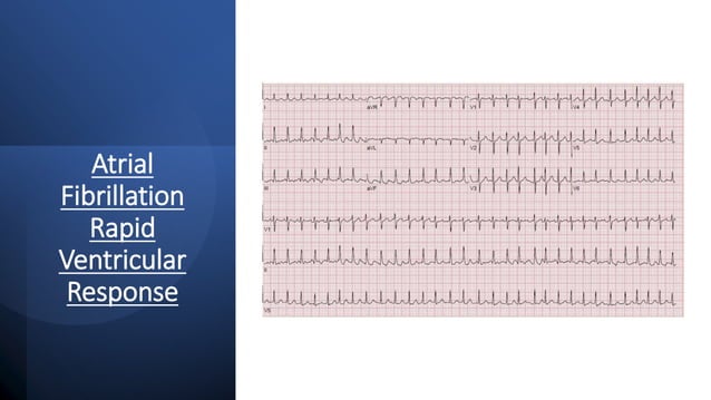 Basic ECG Interpretation.pptx