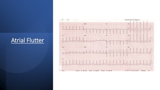 Basic ECG Interpretation.pptx