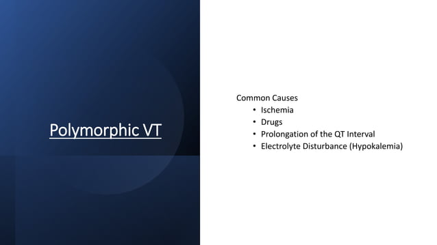Basic ECG Interpretation.pptx