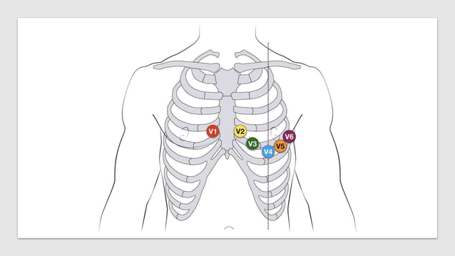 Basic ECG Interpretation.pptx