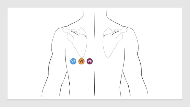 Basic ECG Interpretation.pptx