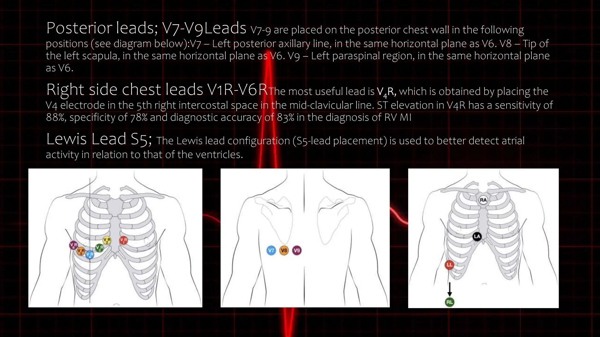 BASIC ECG INTERPRETATION.pptx