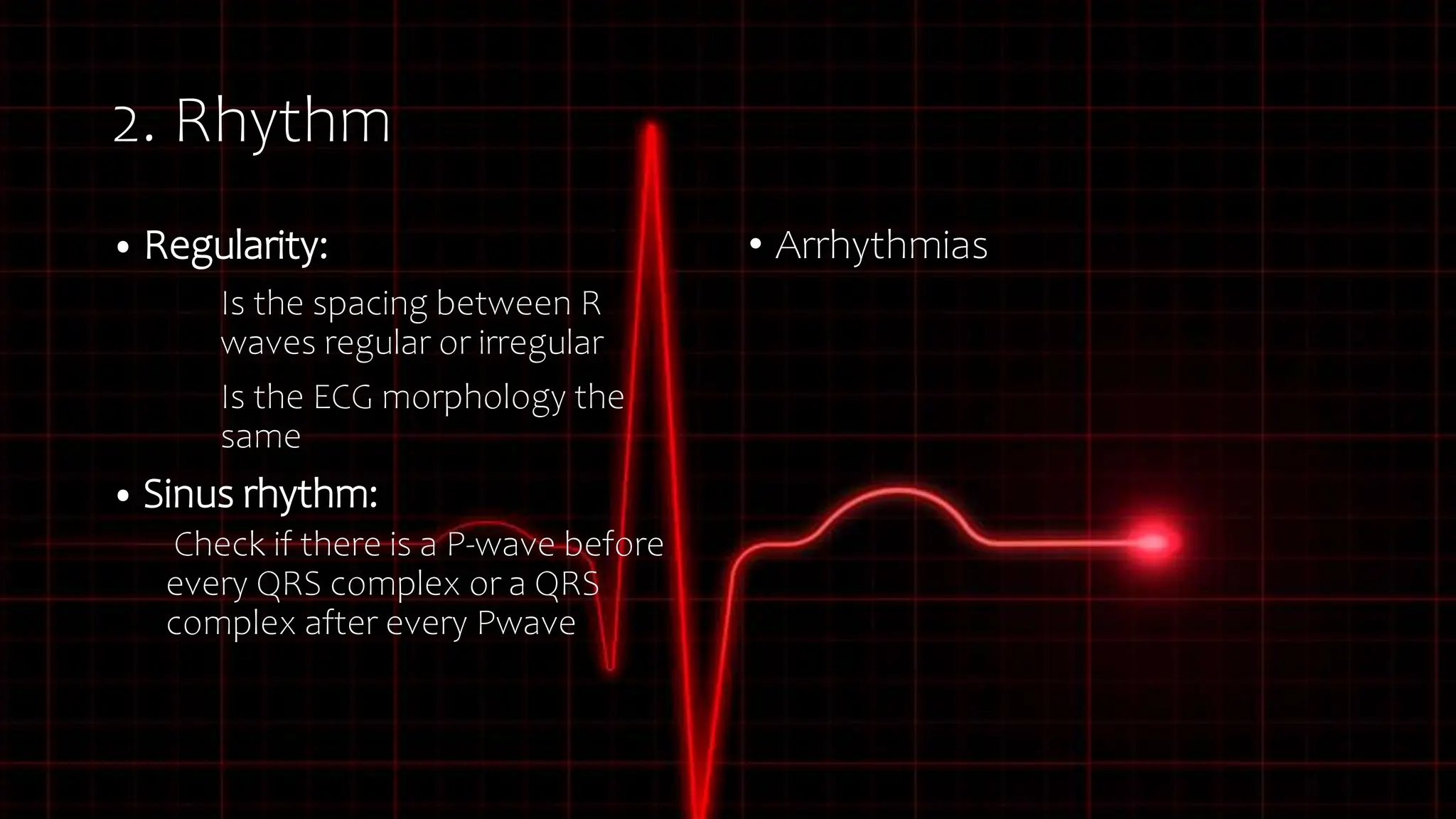 BASIC ECG INTERPRETATION.pptx