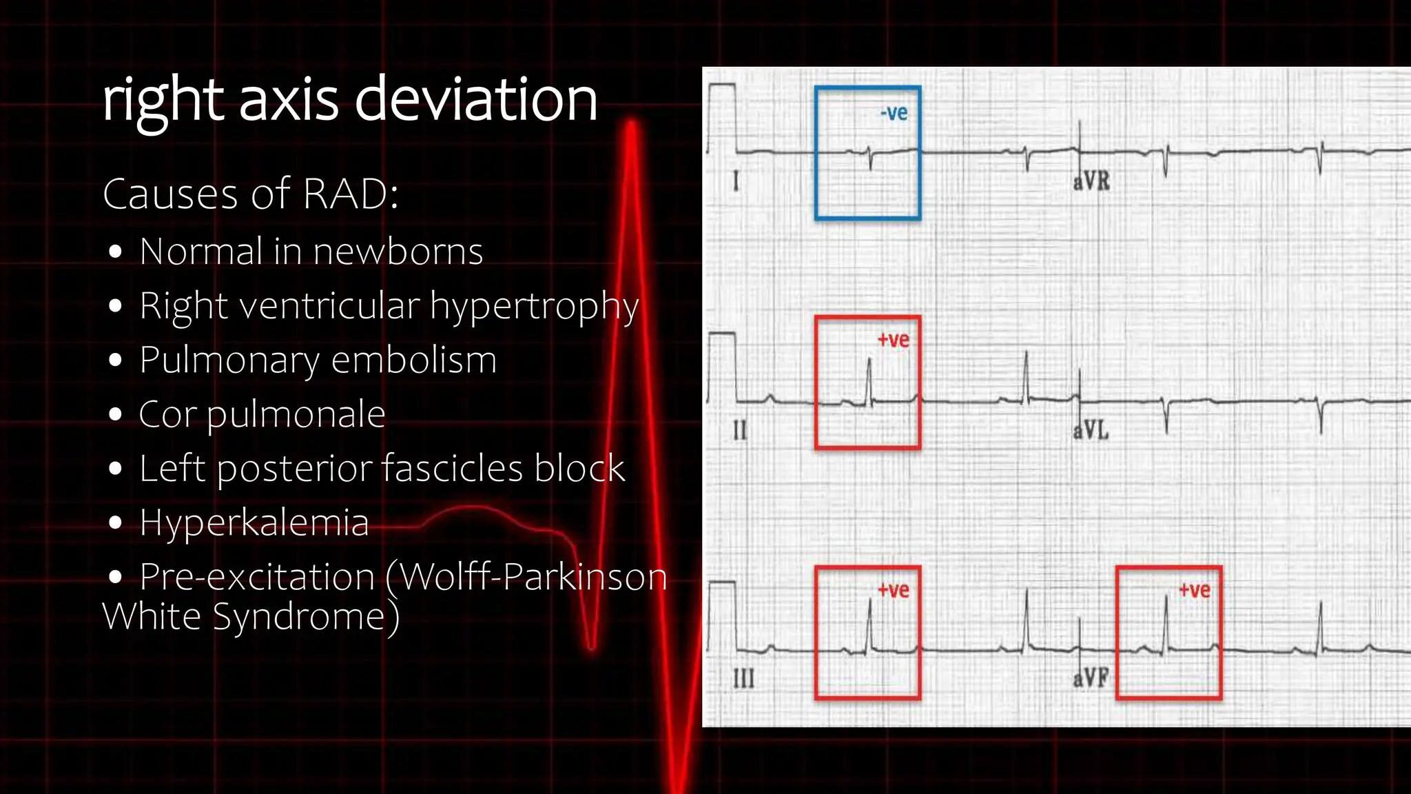 BASIC ECG INTERPRETATION.pptx