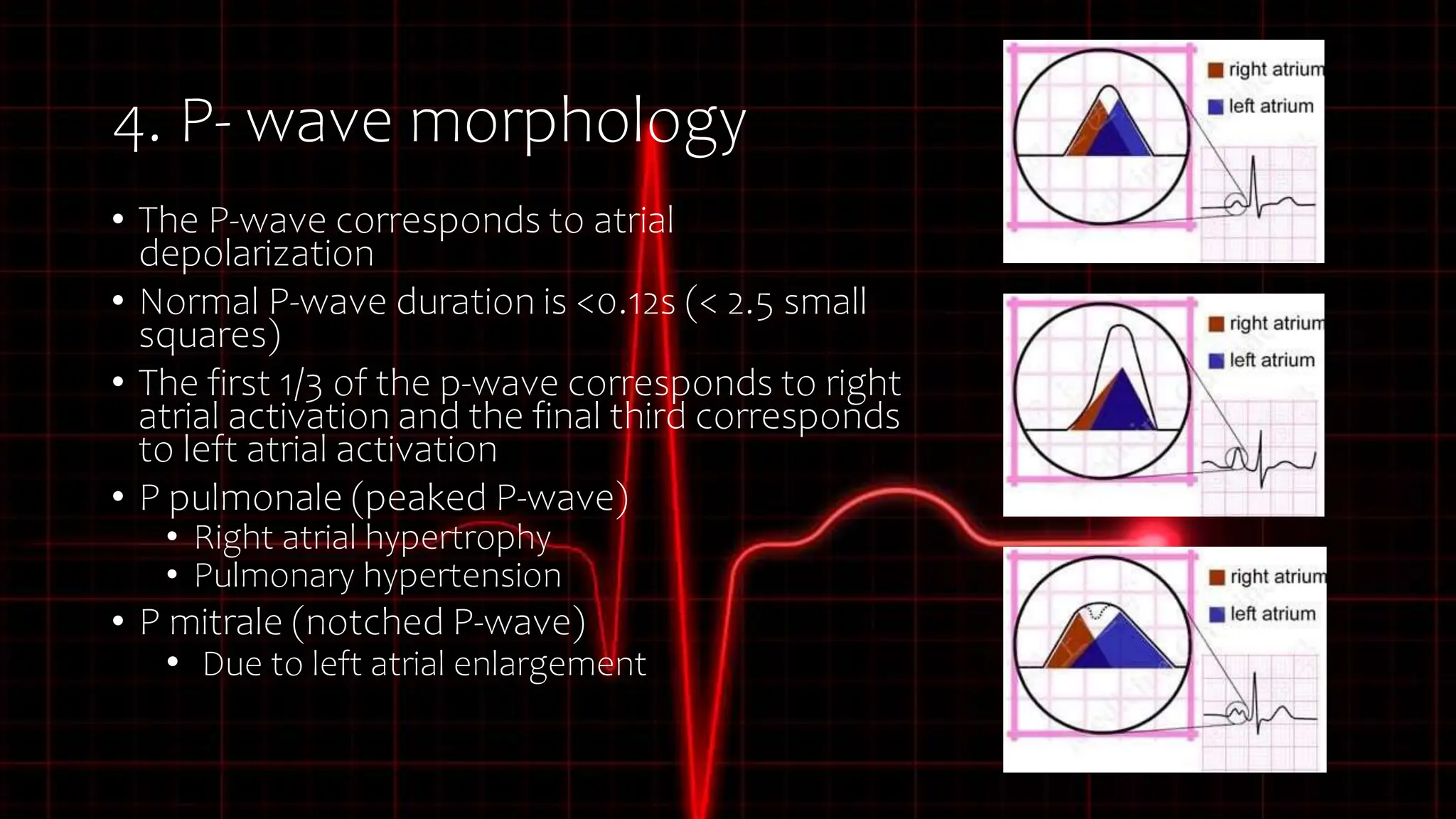 BASIC ECG INTERPRETATION.pptx