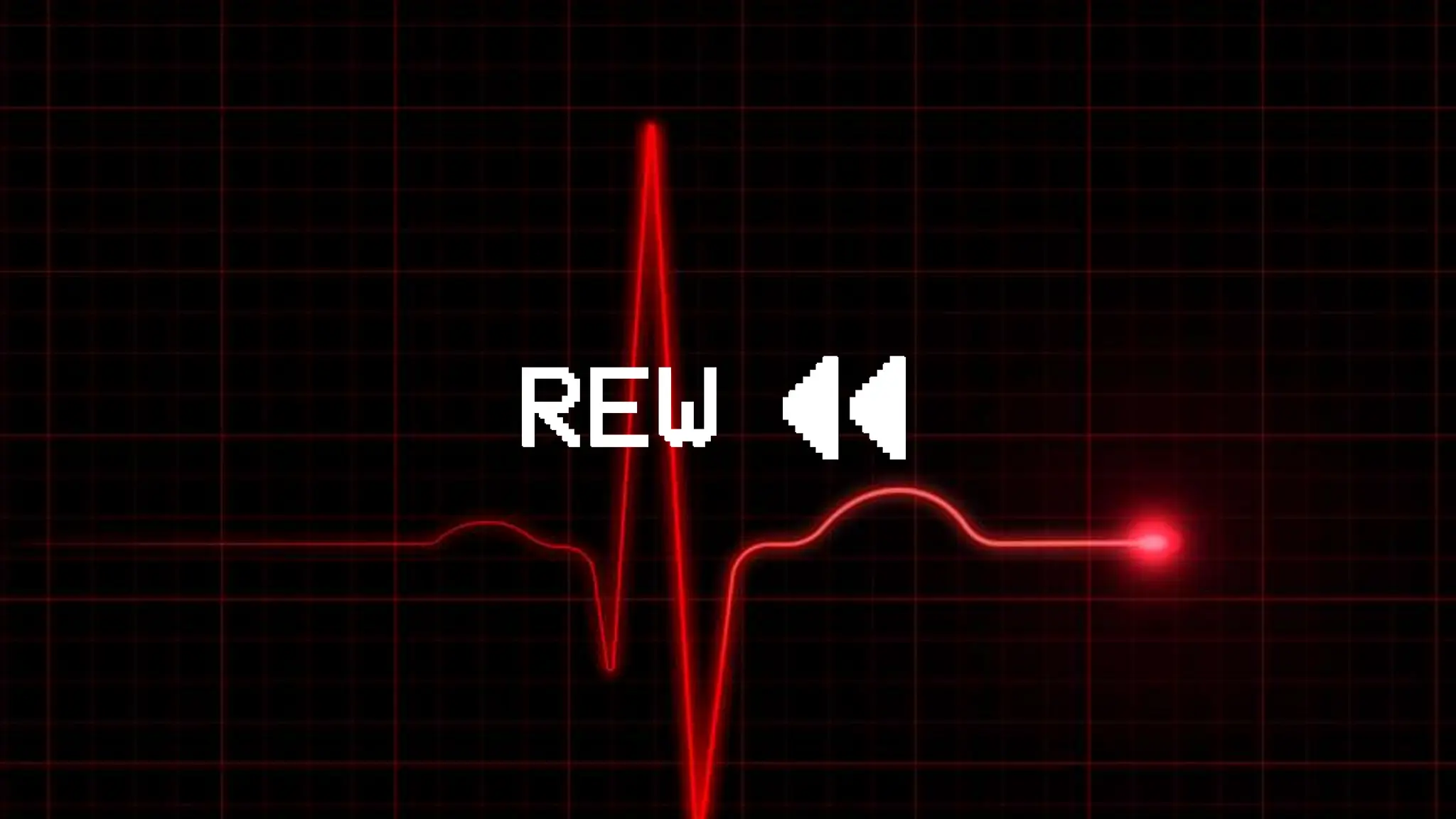 BASIC ECG INTERPRETATION.pptx