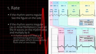 BASIC ECG INTERPRETATION.pptx