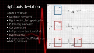 BASIC ECG INTERPRETATION.pptx