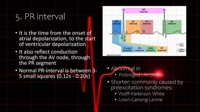 BASIC ECG INTERPRETATION.pptx | Heart and Cardiovascular Diseases ...