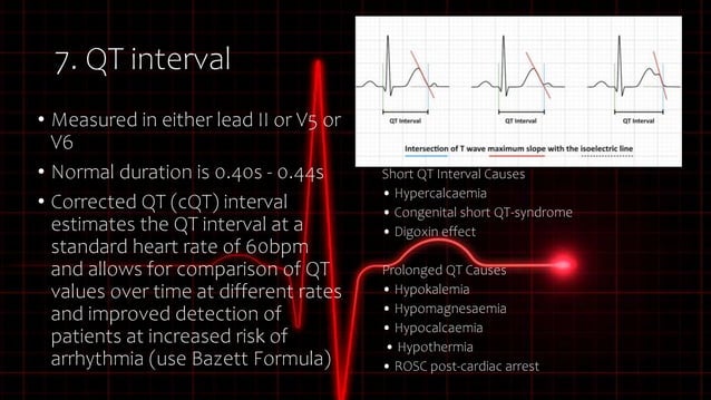 BASIC ECG INTERPRETATION.pptx | Heart and Cardiovascular Diseases ...