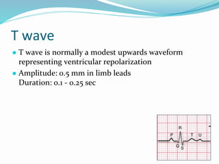 Basic ECG Interpretation for nurses- Leonard.pdf