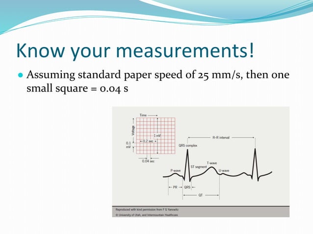 Basic ECG Interpretation for nurses- Leonard.pdf