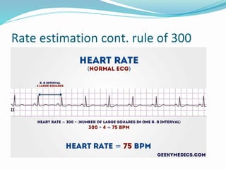 Basic ECG Interpretation for nurses- Leonard.pdf