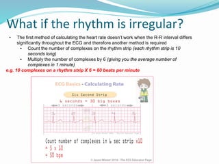 Basic ECG Interpretation for nurses- Leonard.pdf