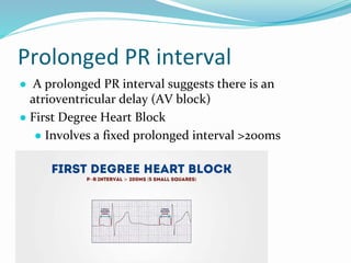 Basic ECG Interpretation for nurses- Leonard.pdf