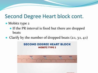 Basic ECG Interpretation for nurses- Leonard.pdf