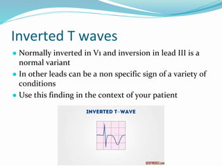 Basic ECG Interpretation for nurses- Leonard.pdf