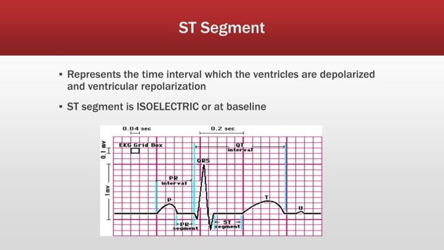Basic Electrocardiography Interpretation.pdf