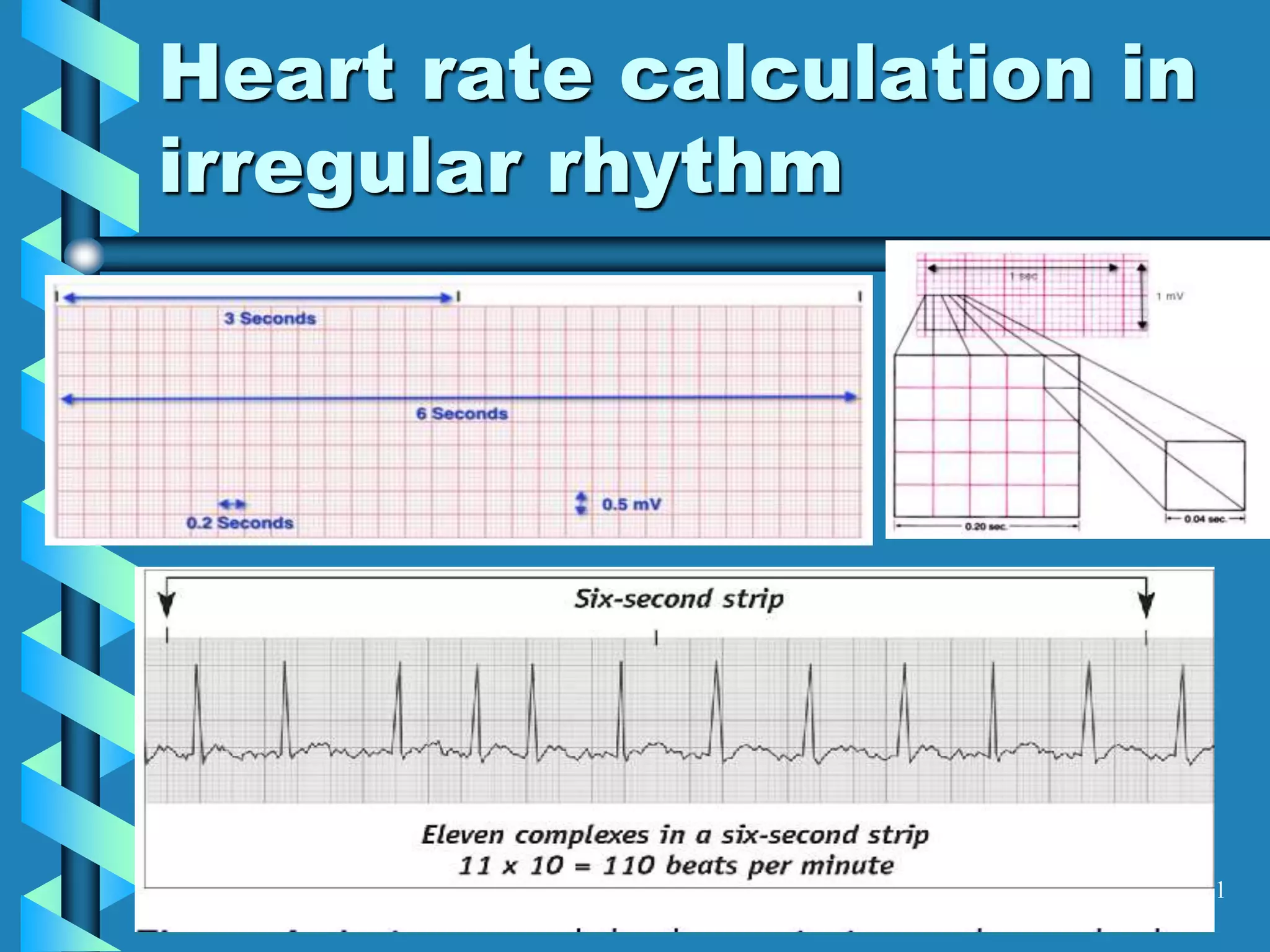 BASIC ECG INTERPRETATION PRESENTATION .ppt