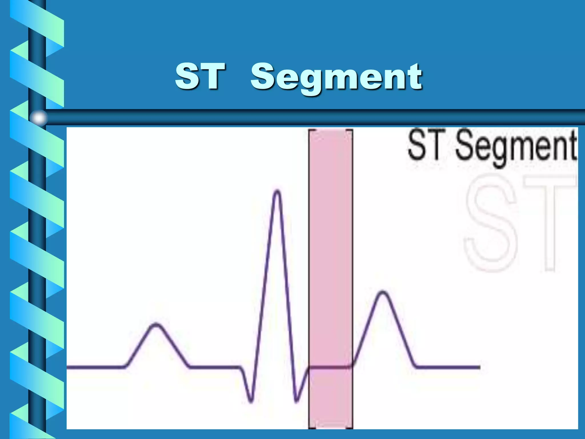 BASIC ECG INTERPRETATION PRESENTATION .ppt