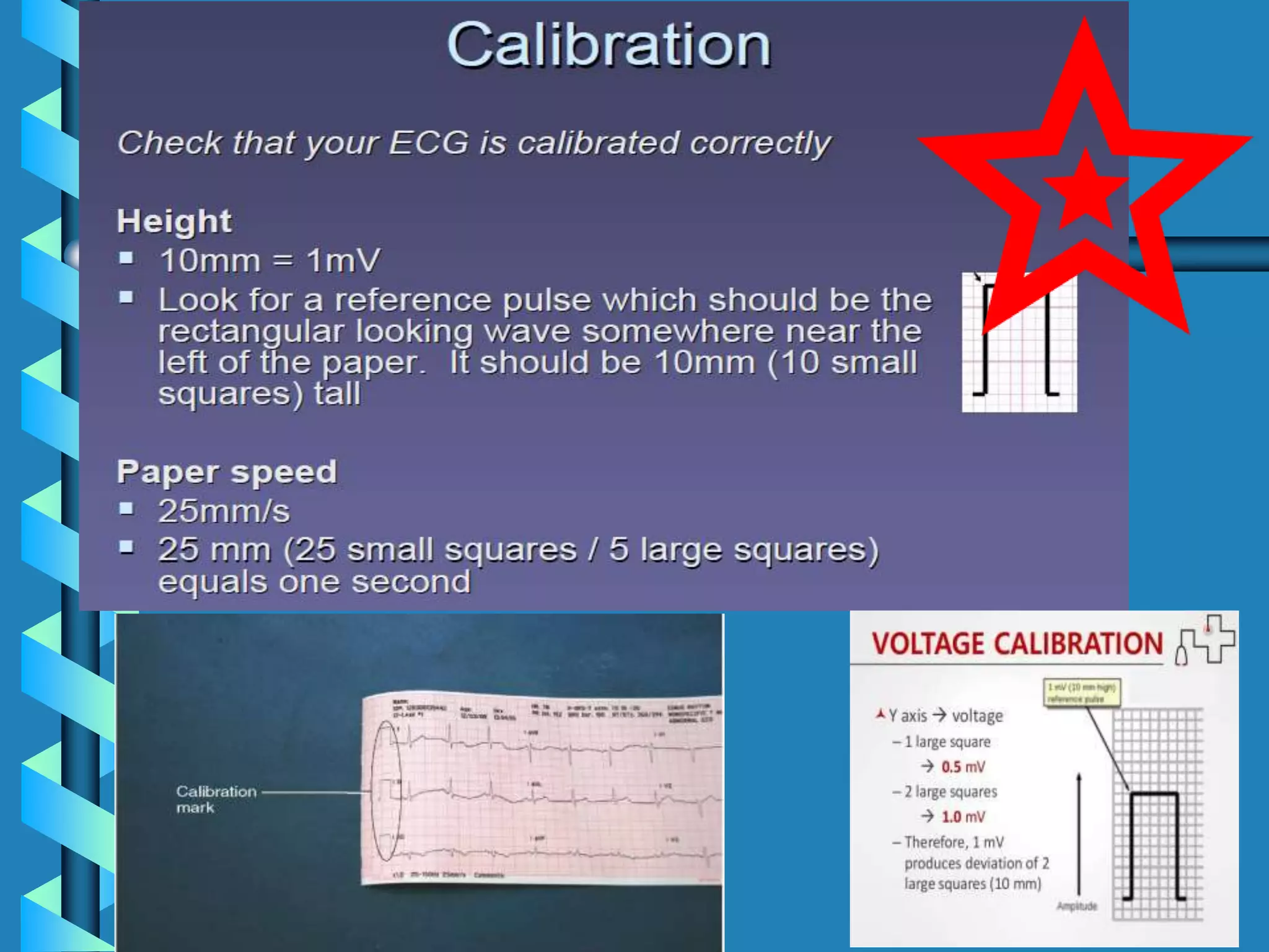 BASIC ECG INTERPRETATION PRESENTATION .ppt