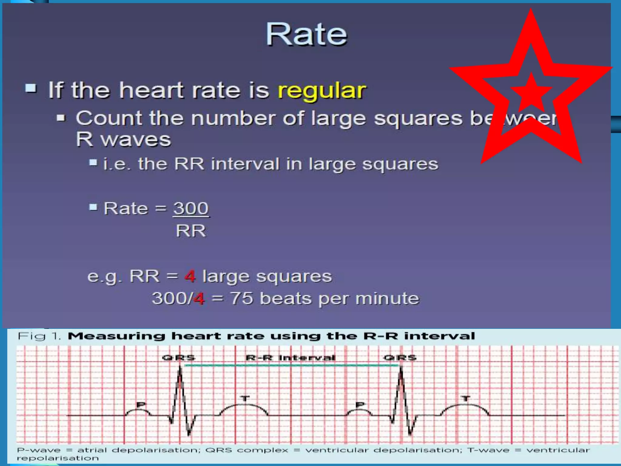 BASIC ECG INTERPRETATION PRESENTATION .ppt