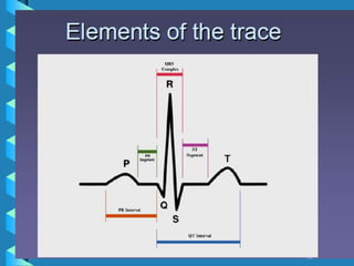BASIC ECG INTERPRETATION PRESENTATION .ppt | Heart and Cardiovascular ...