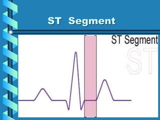 BASIC ECG INTERPRETATION PRESENTATION .ppt | Heart and Cardiovascular ...