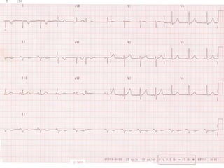 BASIC ECG INTERPRETATION PRESENTATION .ppt | Heart and Cardiovascular ...
