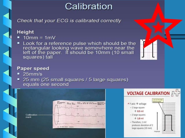 BASIC ECG INTERPRETATION PRESENTATION .ppt | Heart and Cardiovascular ...