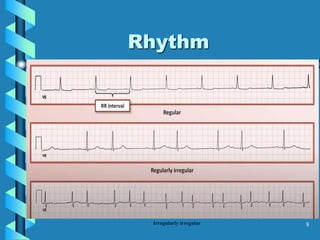 BASIC ECG INTERPRETATION PRESENTATION .ppt | Heart and Cardiovascular ...
