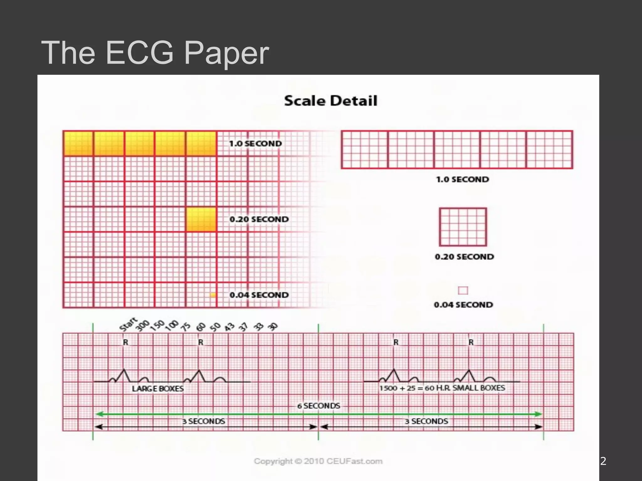Basic ecg interpretations | PDF | Heart and Cardiovascular Diseases ...