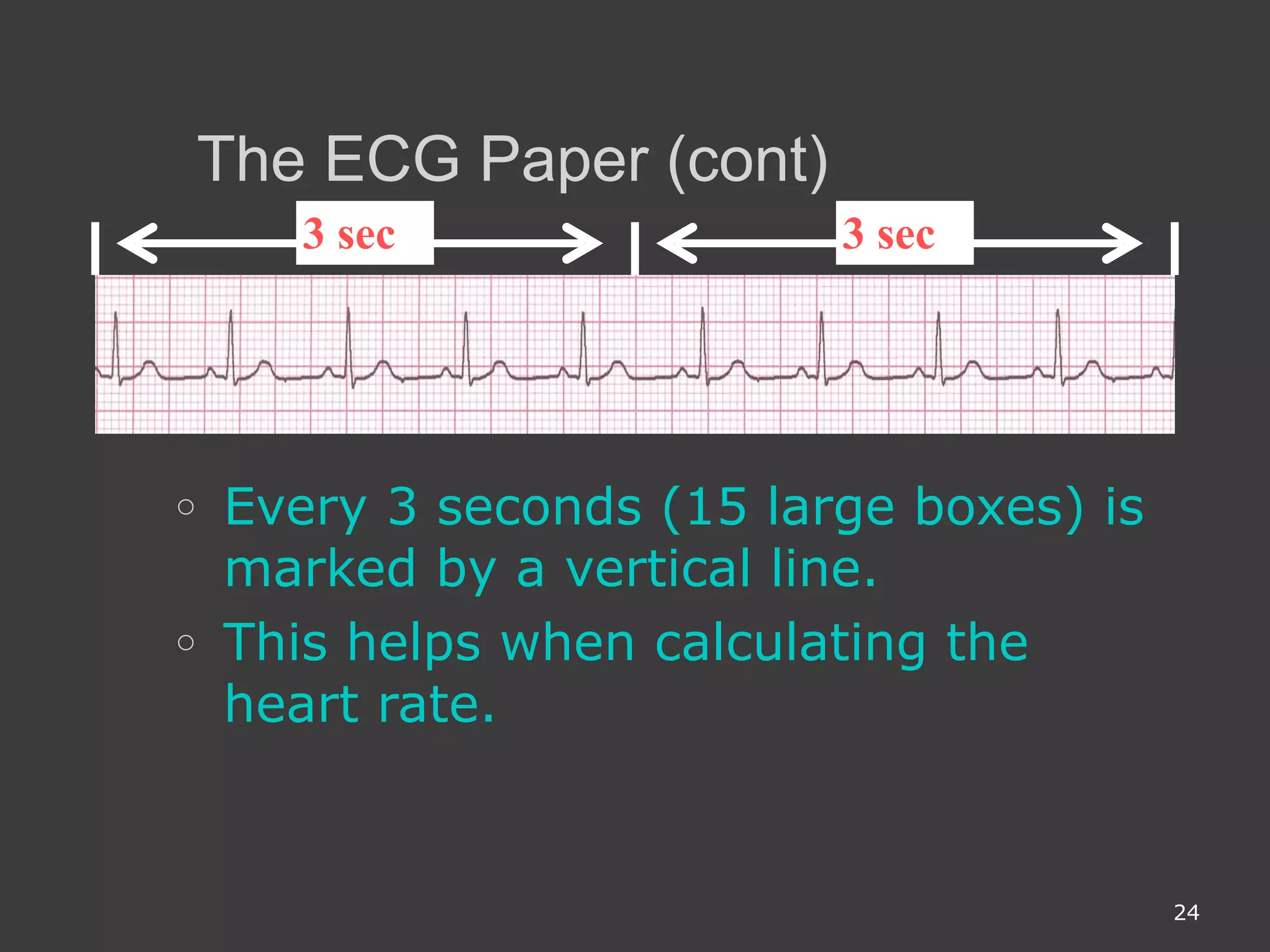 Basic ecg interpretations | PDF | Heart and Cardiovascular Diseases ...