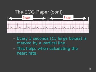 Basic ecg interpretations | PDF