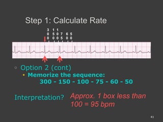 Basic ecg interpretations | PDF